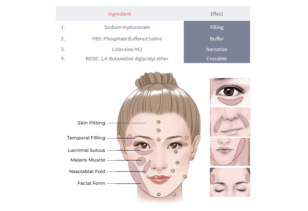 Hyaluronic Acid Dermal Filler - Acmisawa